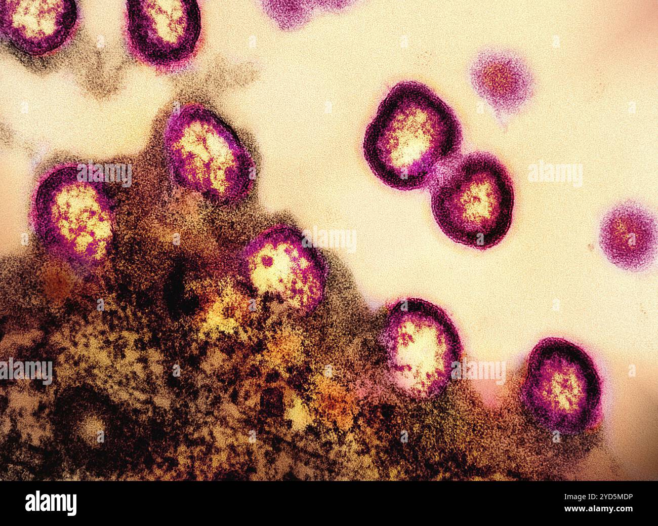 Transmission electron micrograph of HIV-1 virus particles (colorized ...