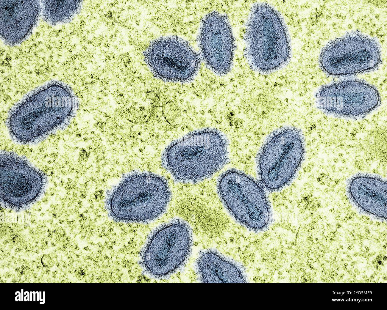 Colorized transmission electron micrograph of mpox virus particles ...