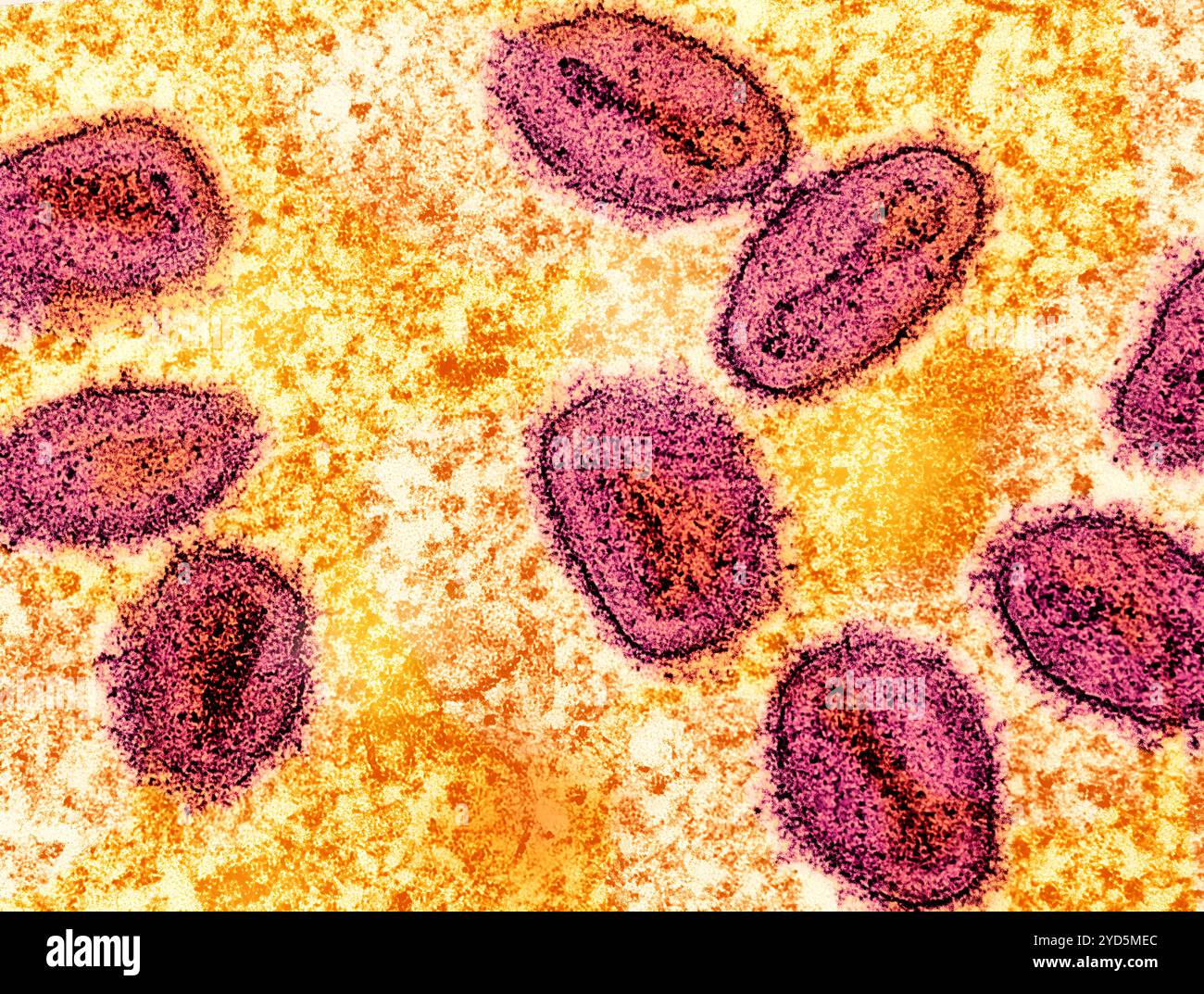 Colorized transmission electron micrograph of mpox virus particles ...