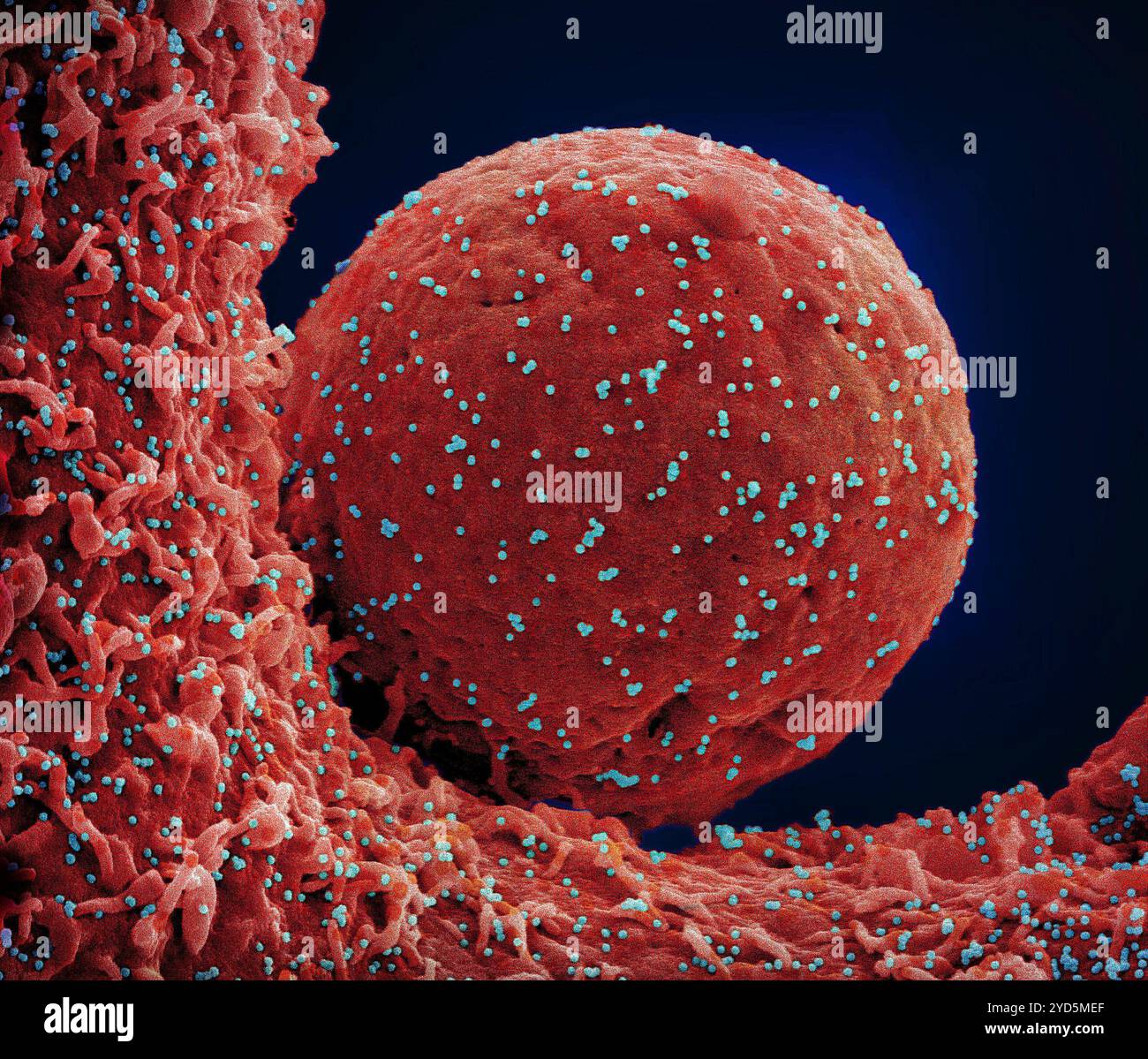 Colorized scanning electron micrograph of a cell (red) infected with ...