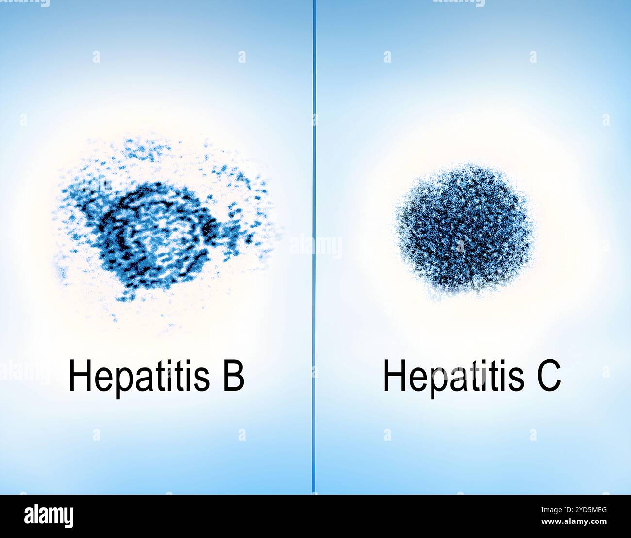 Side-by-side transmission electron micrograph images of hepatitis B and ...