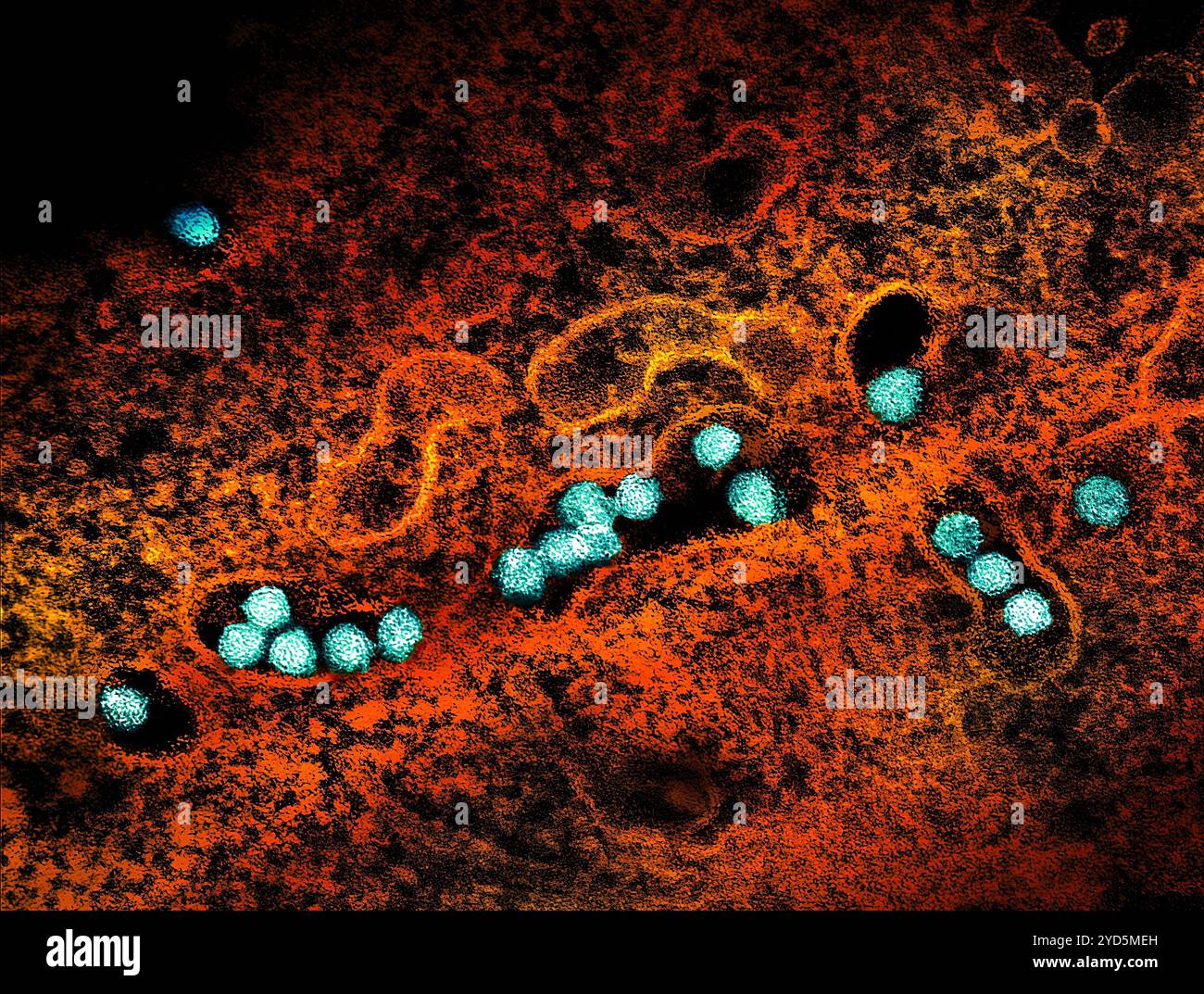 Transmission electron micrograph of West Nile virus particles (teal ...
