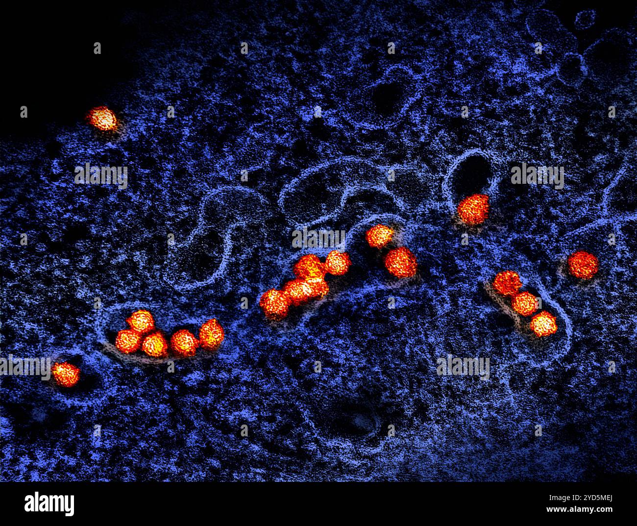 Transmission electron micrograph of West Nile virus particles (orange ...