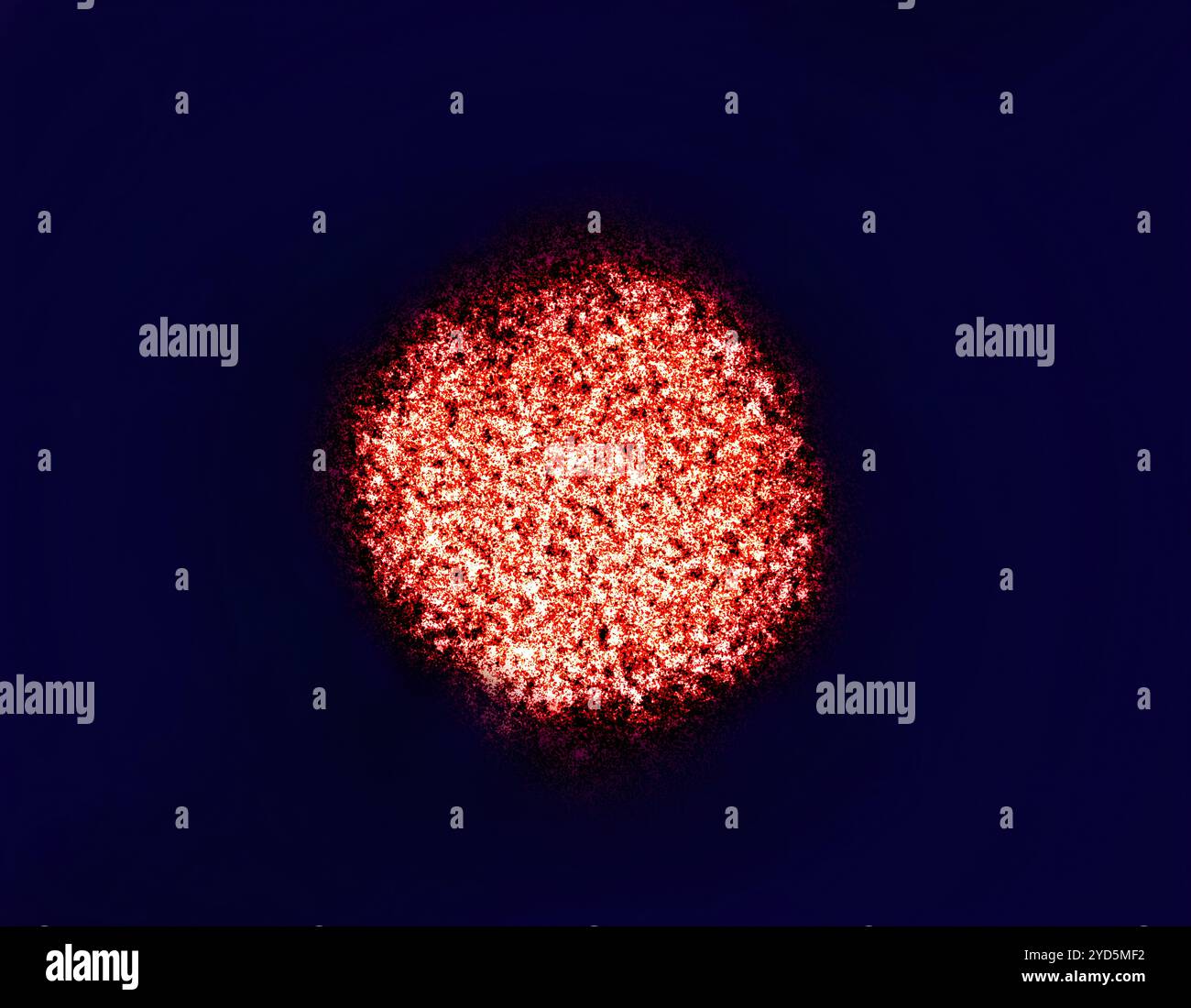 Colorized transmission electron micrograph of a hepatitis C virion ...
