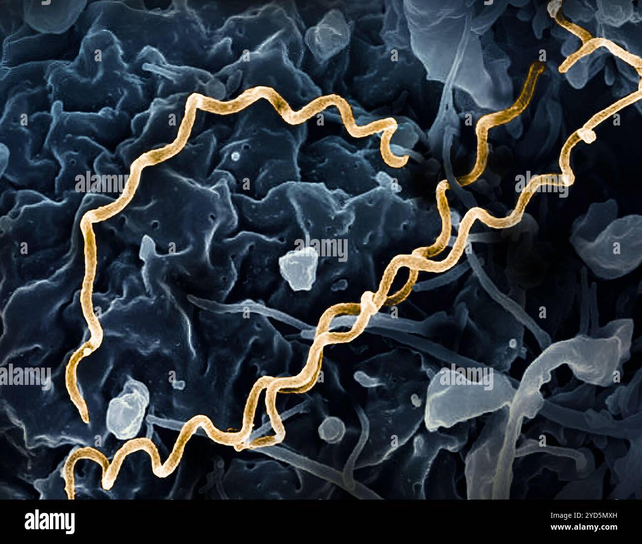 Colorized electron micrograph of Treponema pallidum, the bacteria that cause syphilis. Several ...