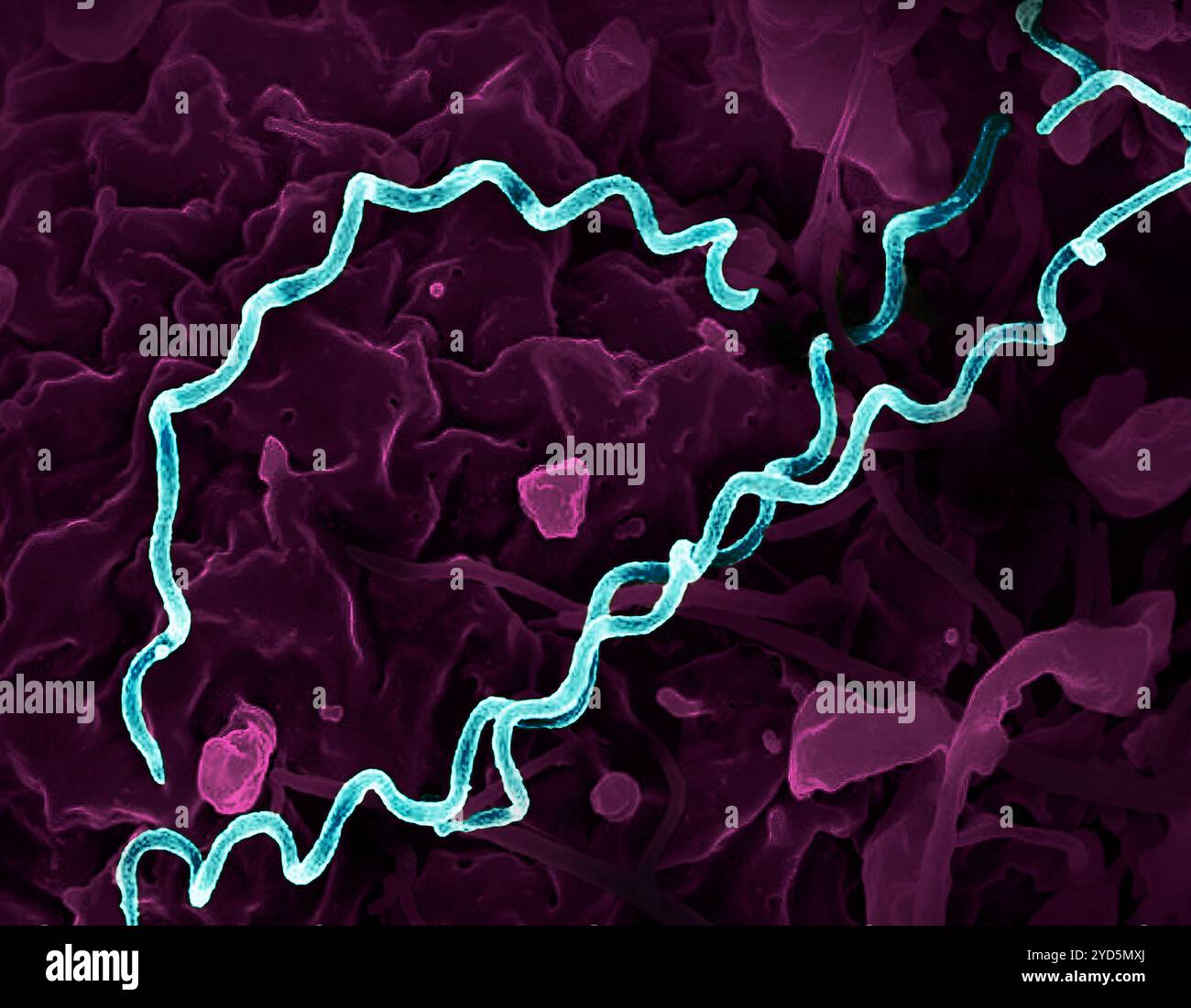 Colorized electron micrograph of Treponema pallidum, the bacteria that cause syphilis. Several ...