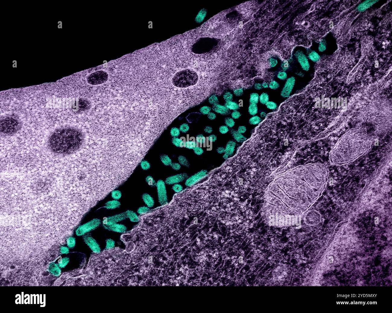 Transmission electron micrograph of vesicular stomatitis virus (VSV ...