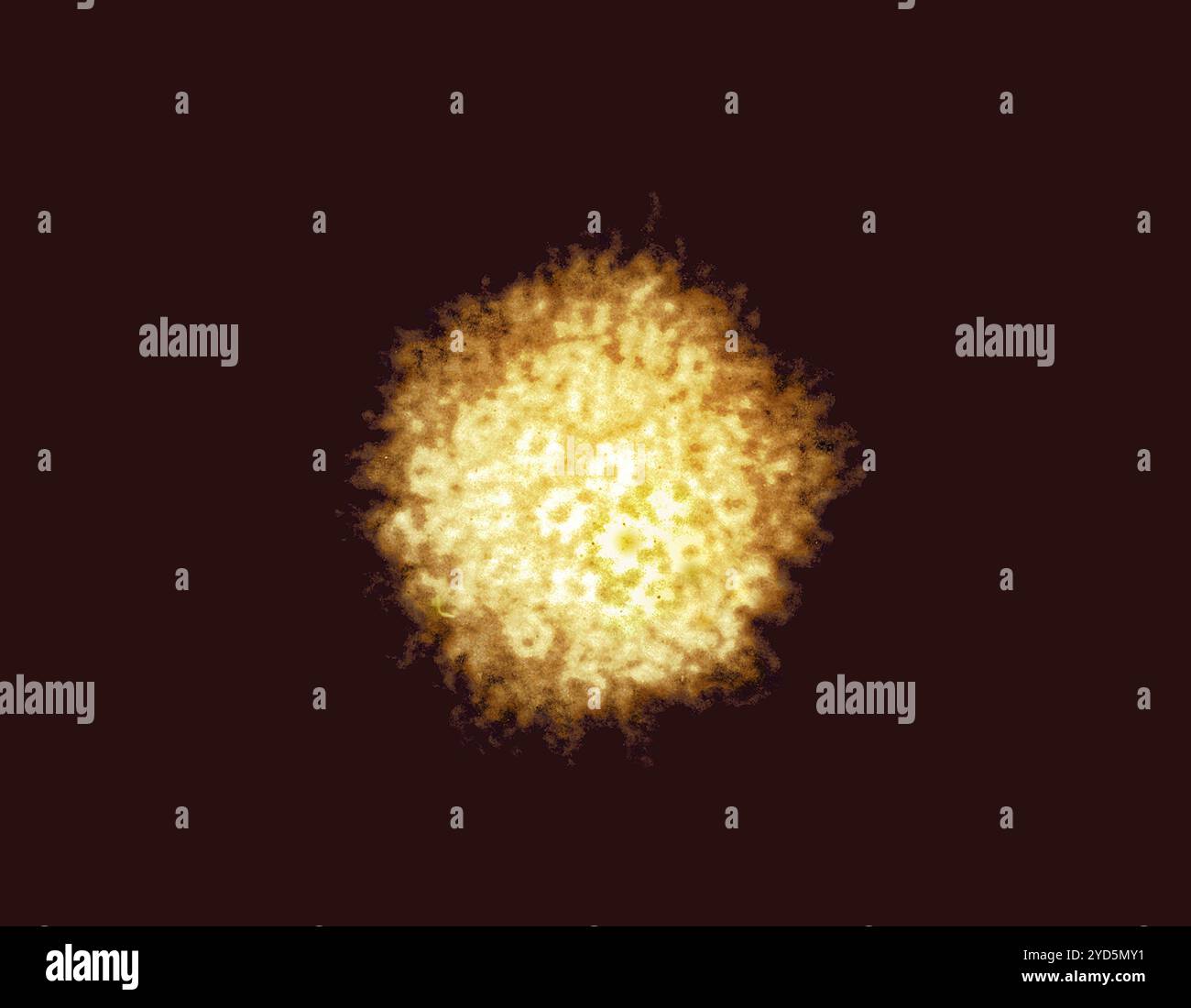 Colorized electron micrograph of the herpes simplex virus (HSV Stock ...
