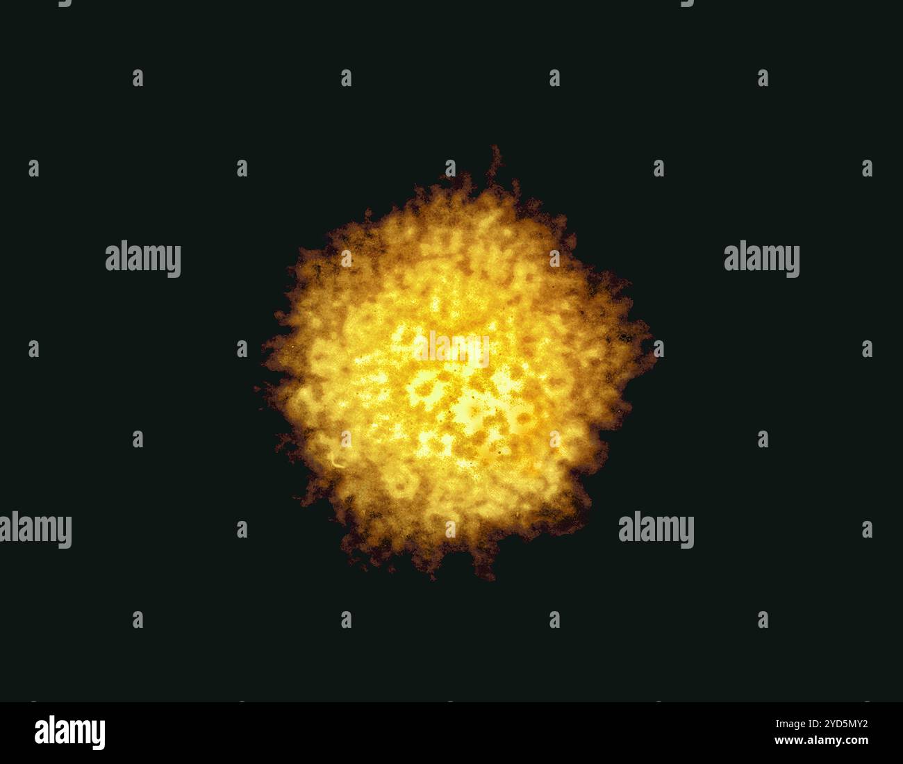 Colorized electron micrograph of the herpes simplex virus (HSV Stock ...