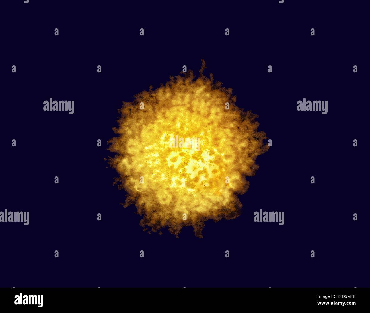 Colorized electron micrograph of the herpes simplex virus (HSV Stock ...