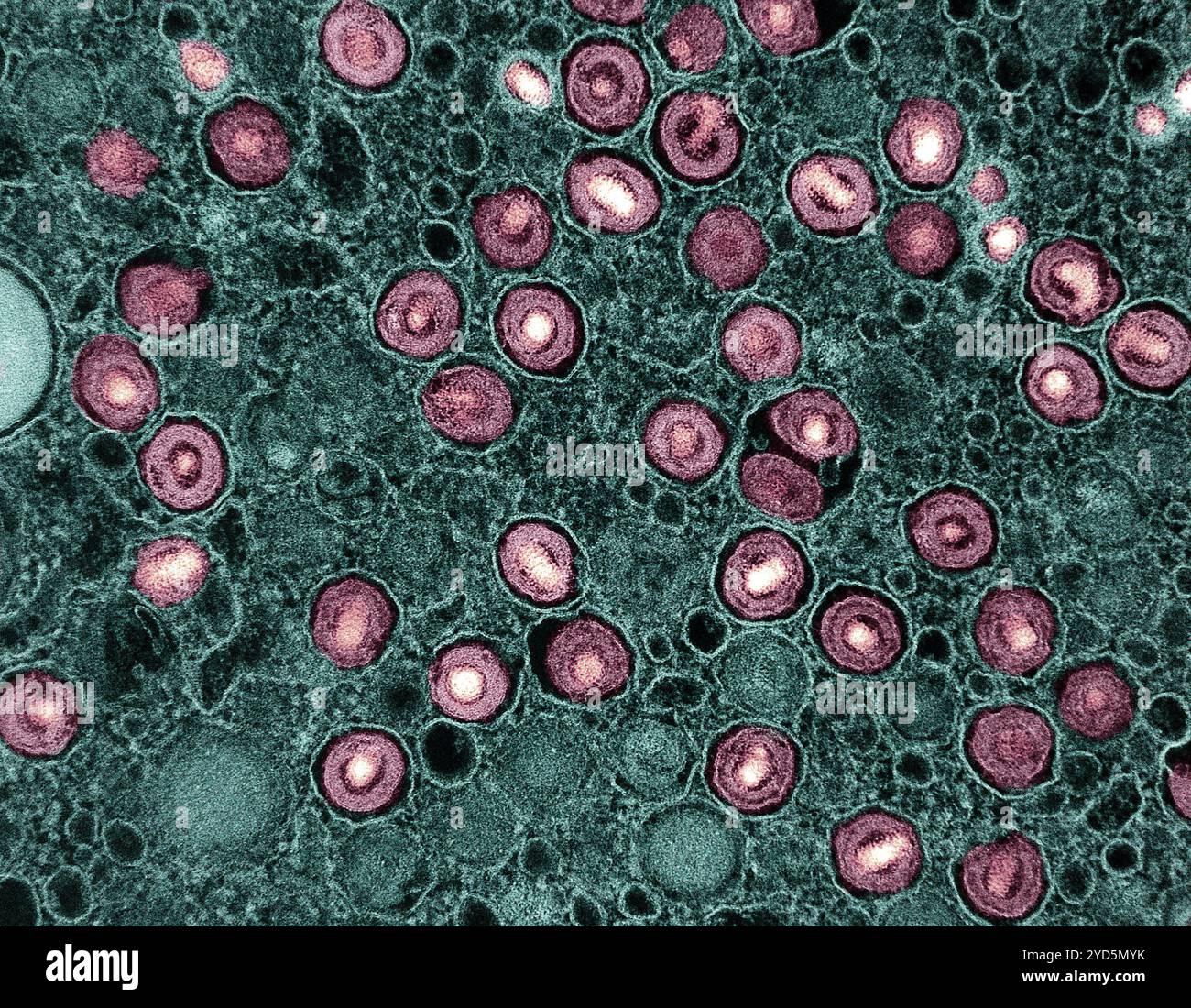 Electron microscope cytomegalovirus hi-res stock photography and images - Alamy