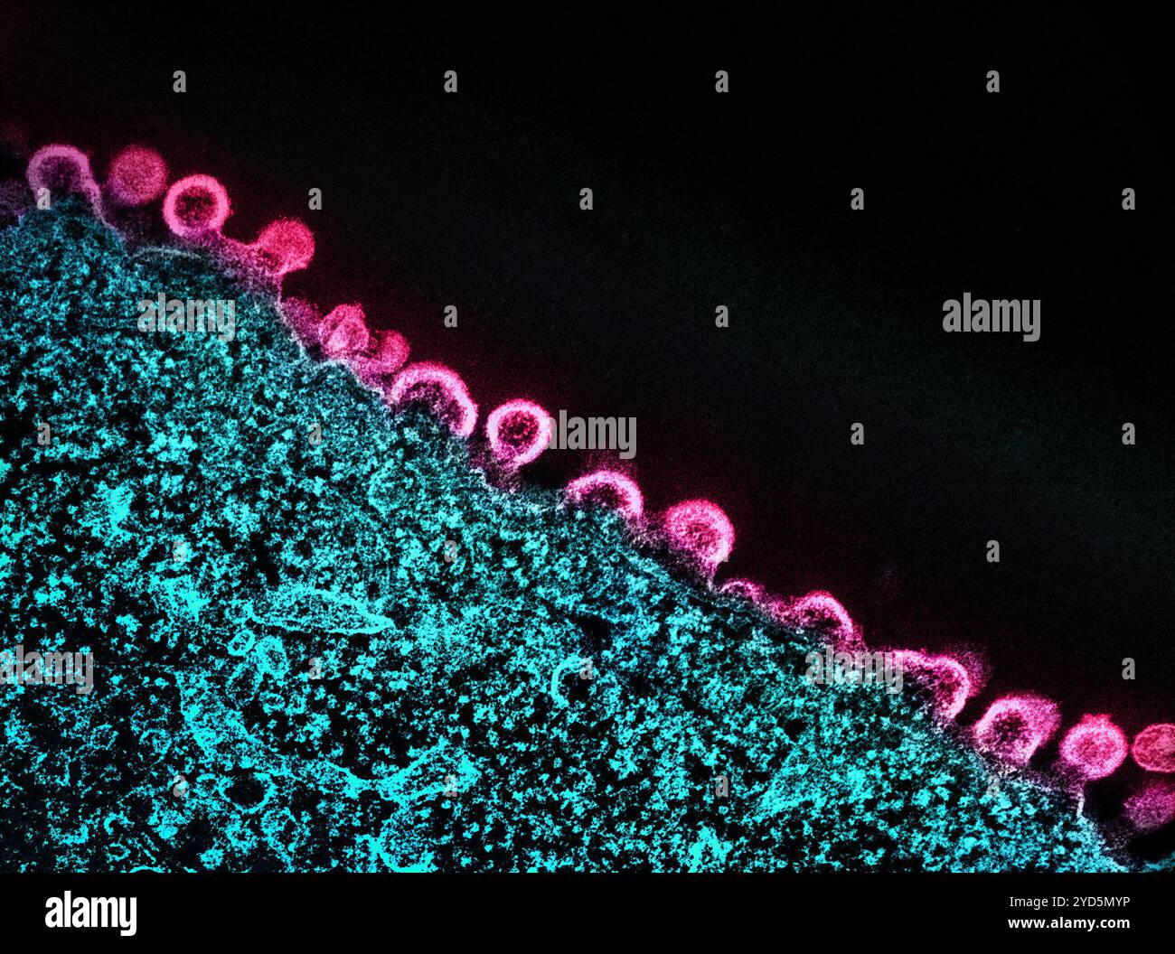 Colorized transmission electron micrograph of HIV-1 virus particles ...