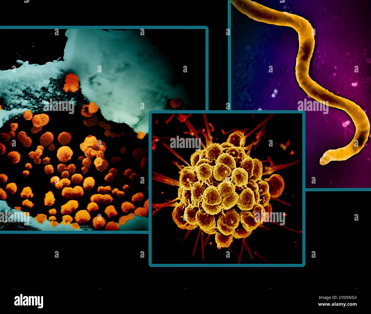 Electron micrograph imagery of bacteria that cause three sexually ...