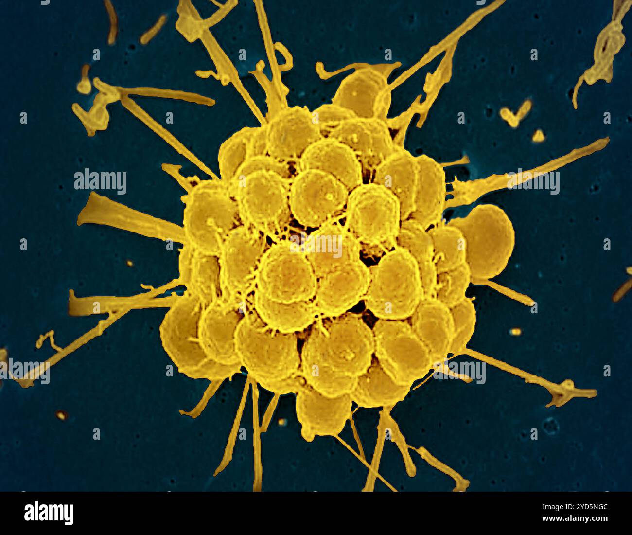 Gonococcus Structure Disease That Causes Neisseria Image: Scanning