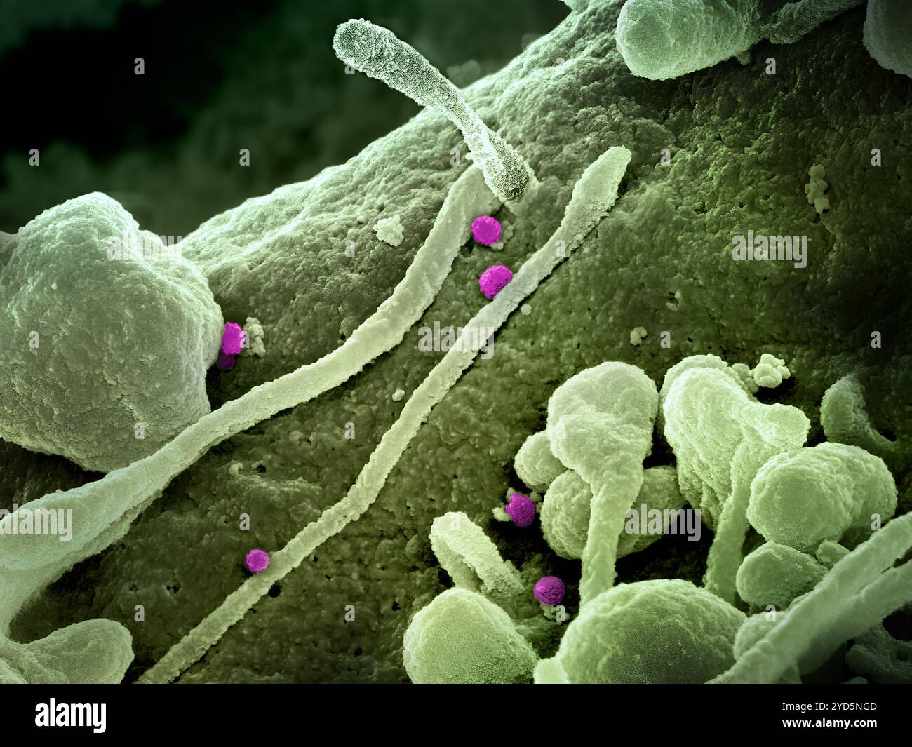 Colorized scanning electron micrograph of Crimean-Congo hemorrhagic ...