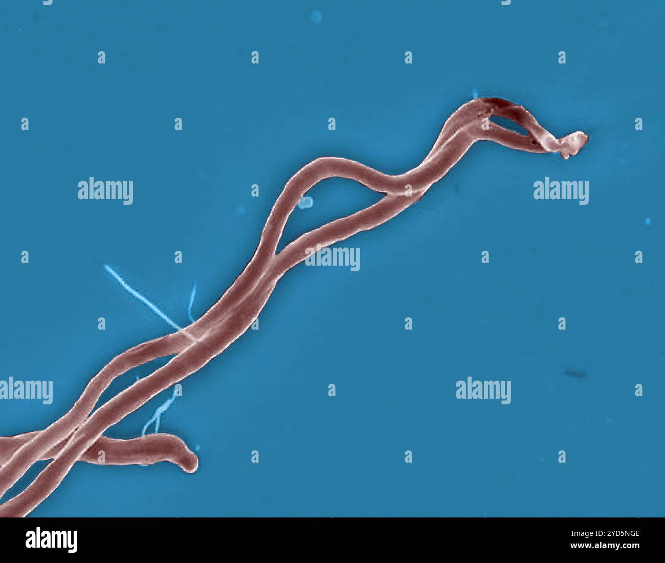 Borrelia burgdorferi bacteria (colorized red), which can cause Lyme ...