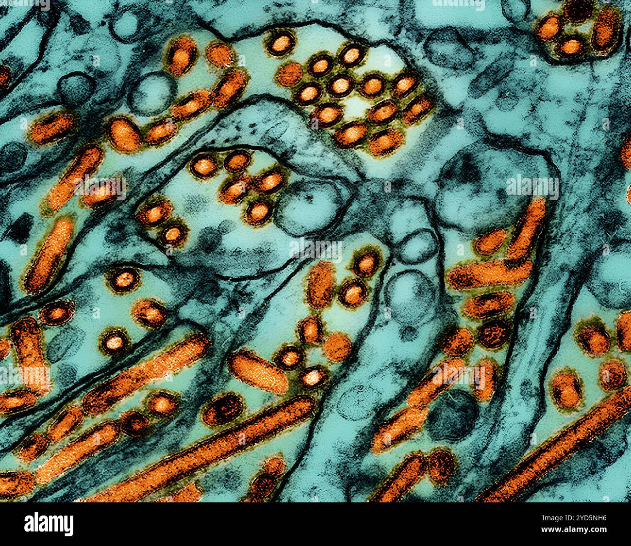 Colorized transmission electron micrograph of avian influenza A H5N1 ...