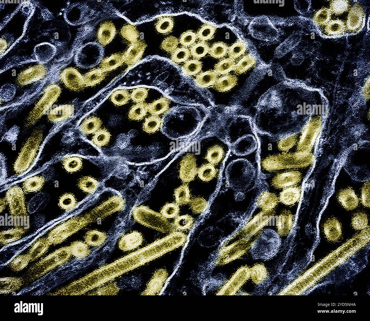 Colorized transmission electron micrograph of avian influenza A H5N1 ... Colorized transmission electron micrograph of avian influenza A H5N1 ...