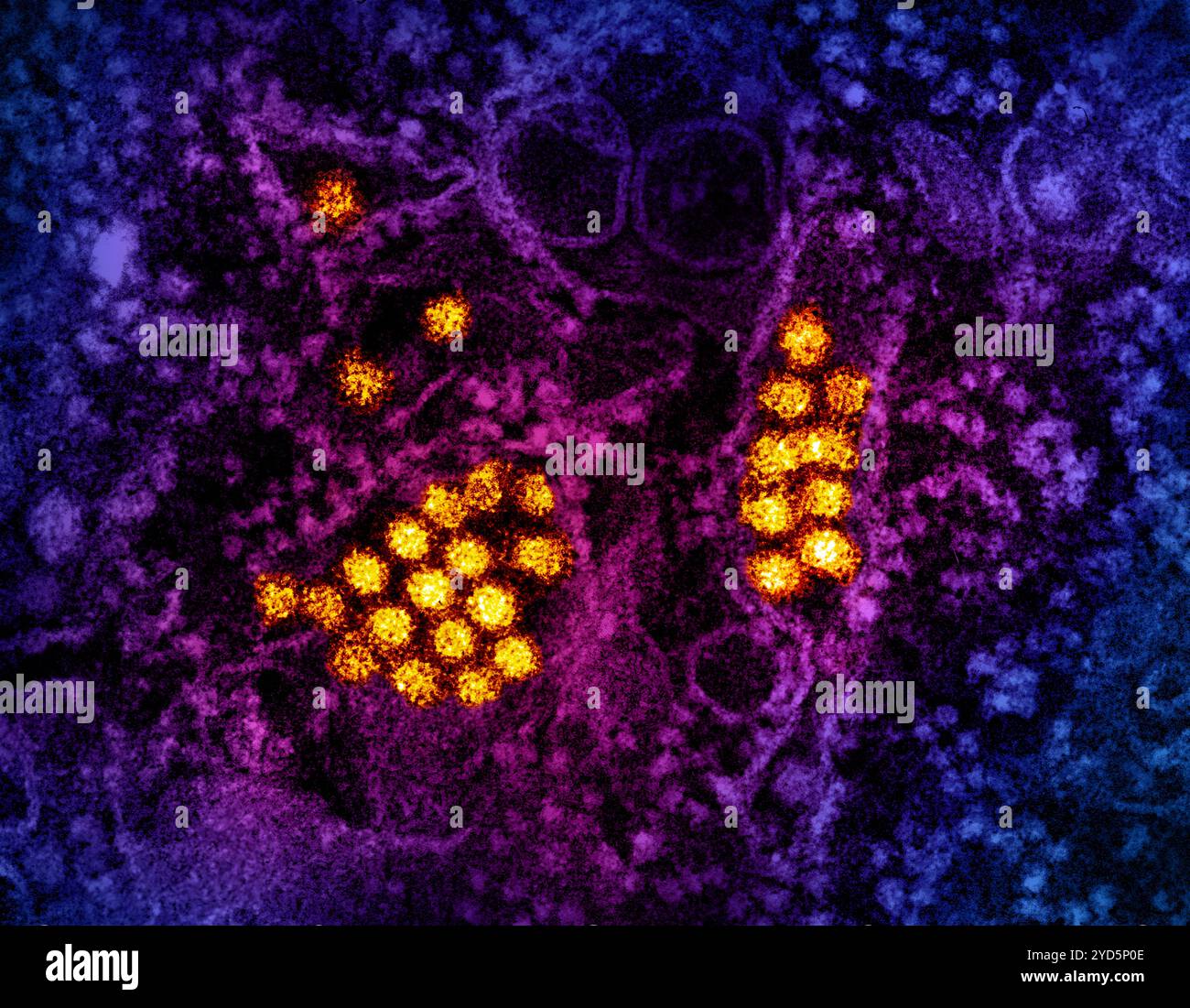 Transmission electron micrograph of dengue virus particles (gold Stock ...