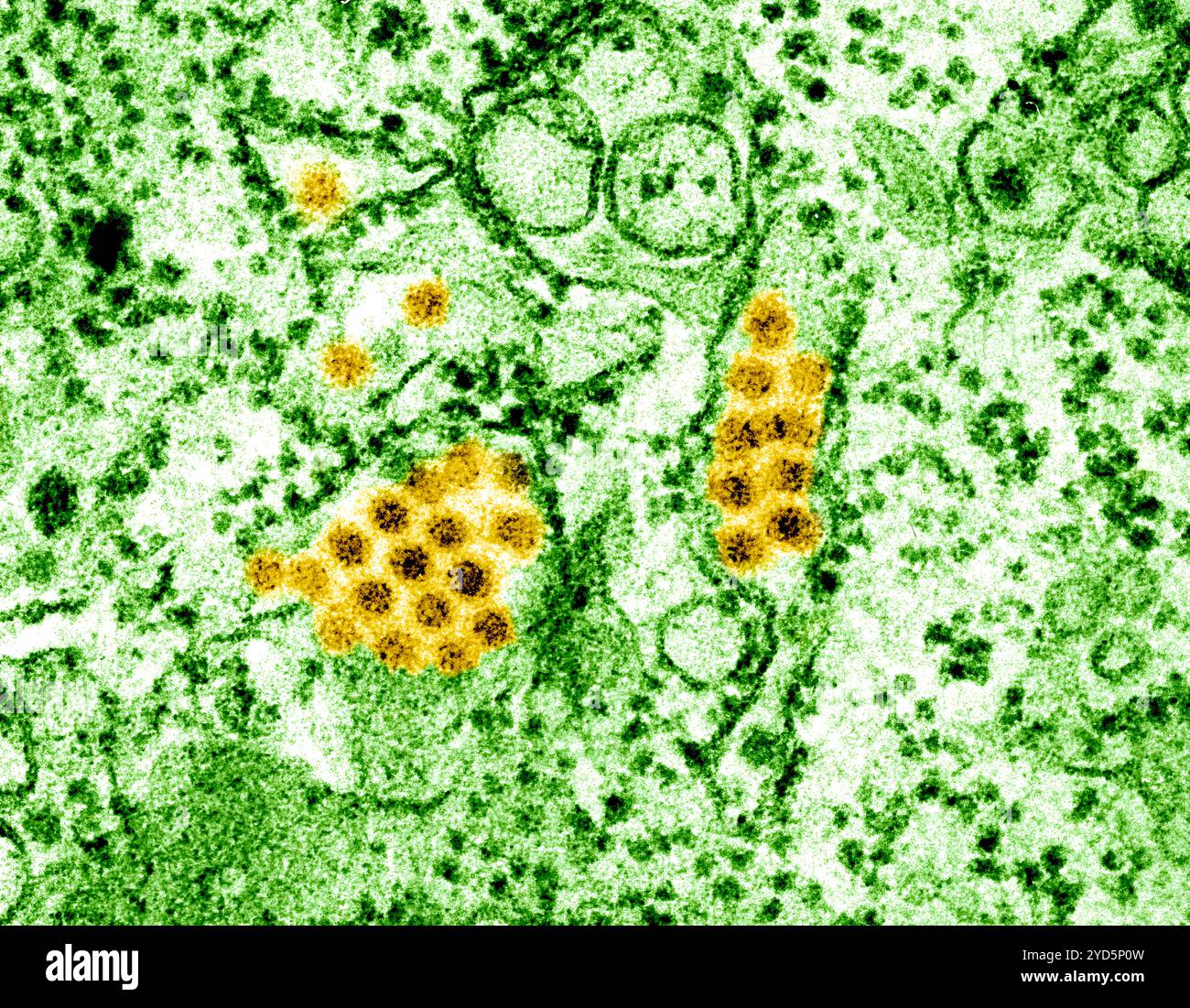 Transmission electron micrograph of dengue virus particles (yellow ...