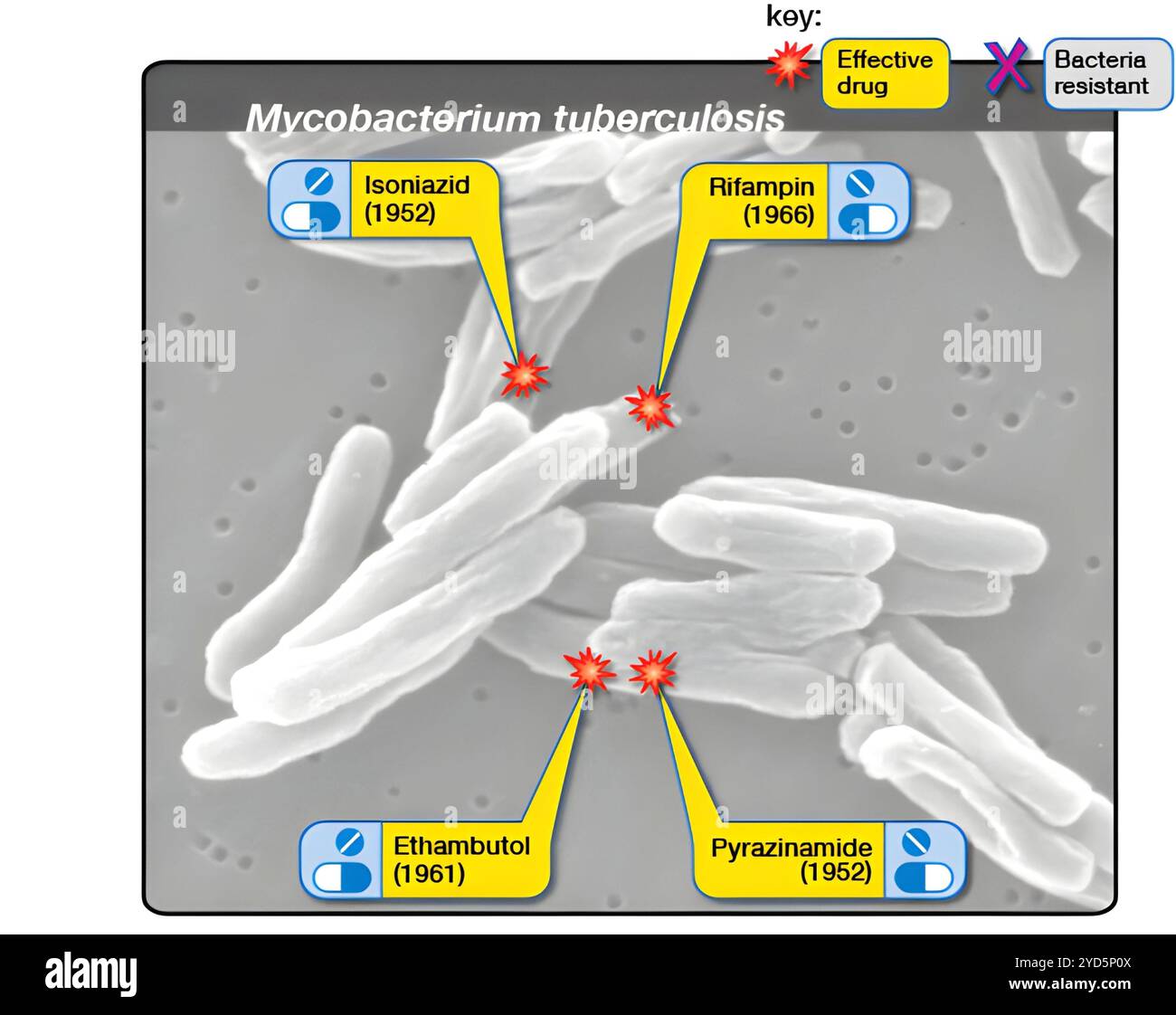 Tuberculosis, which results from an infection with Mycobacterium ...
