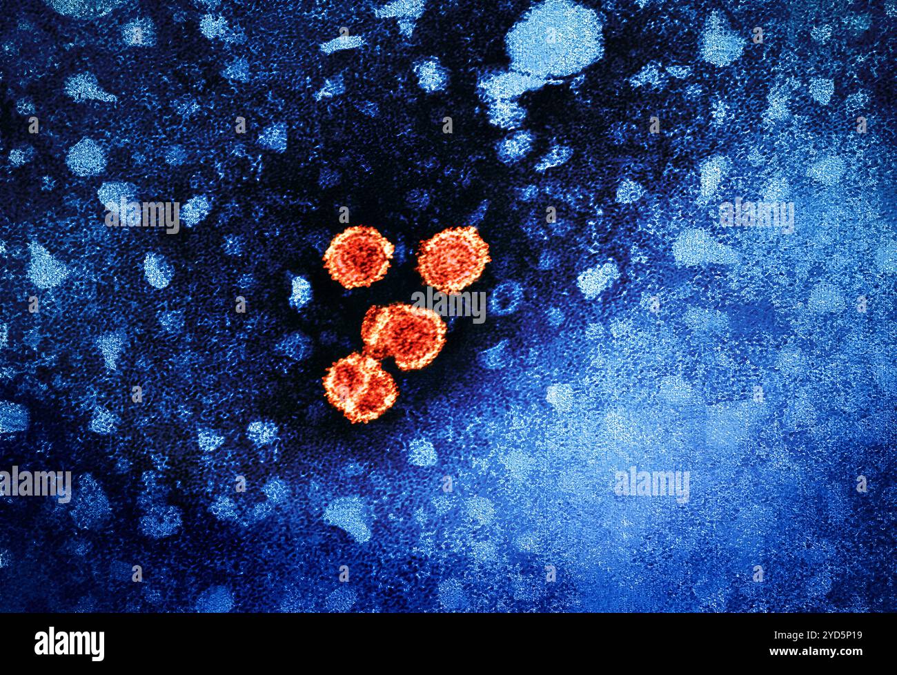 1981 Dr. Erskine Palmer This transmission electron micrograph (TEM ...