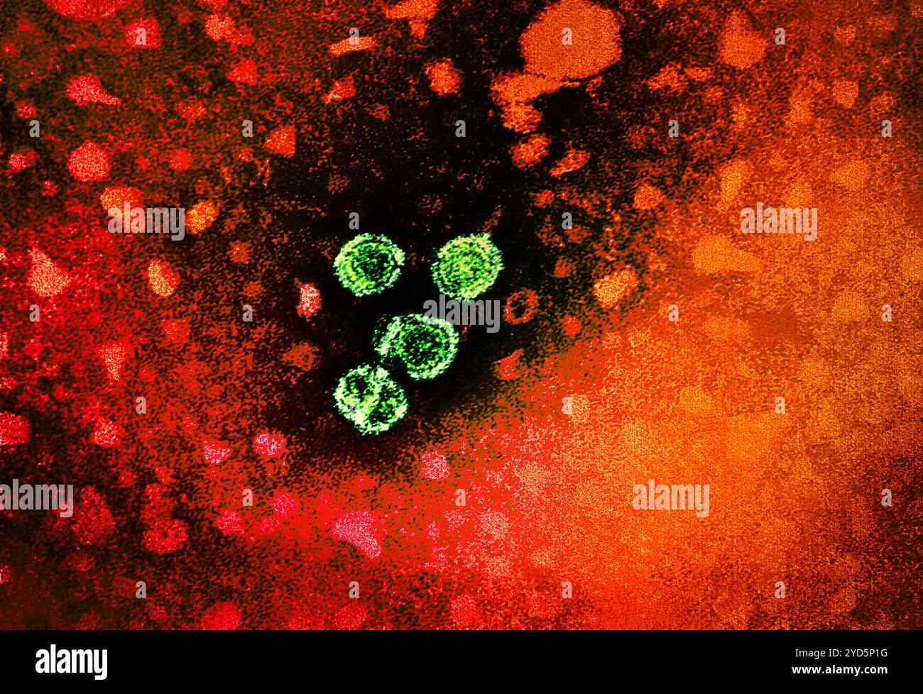 1981 Dr. Erskine Palmer This transmission electron micrograph (TEM ...