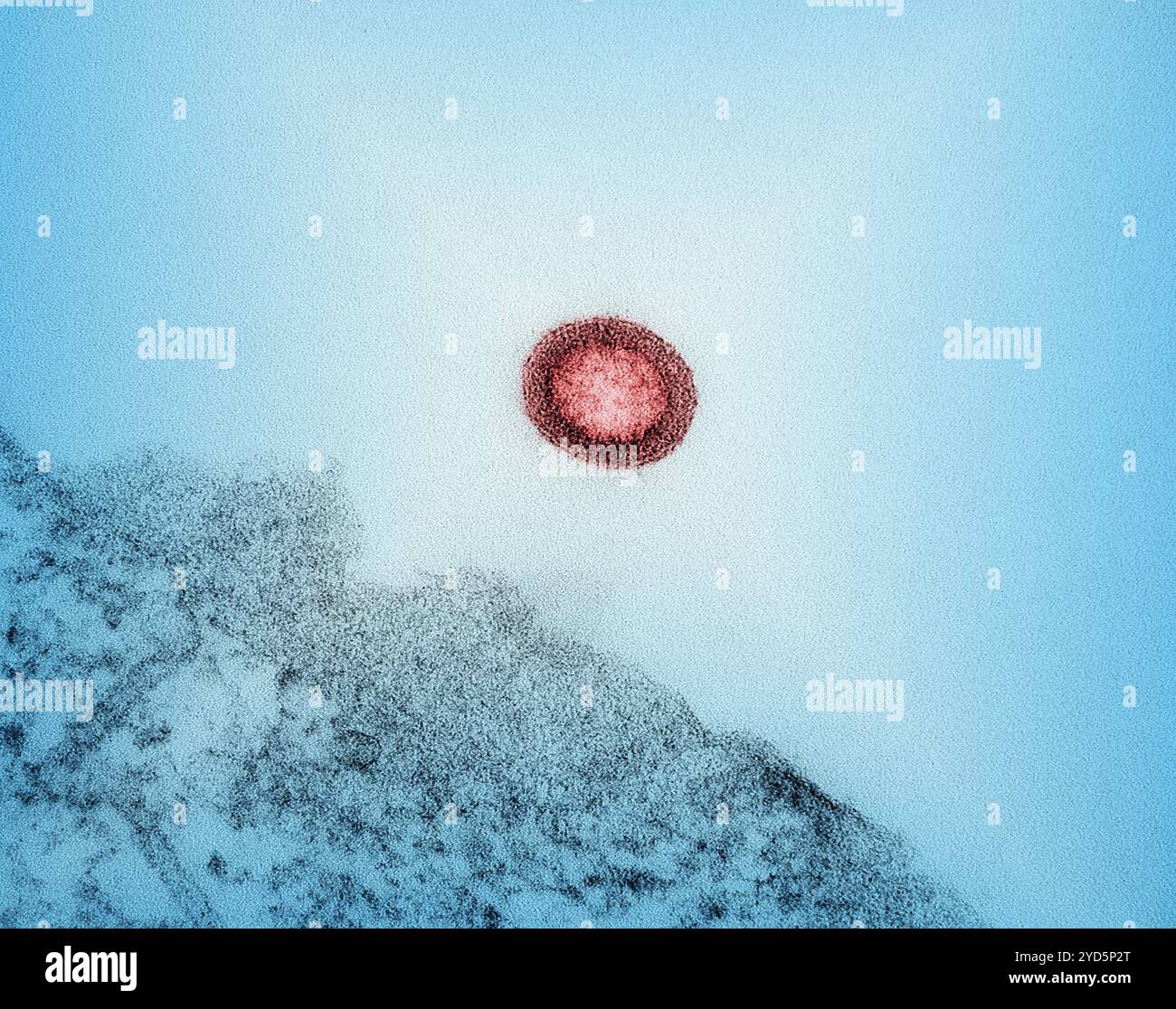 Colorized transmission electron micrograph of an extracellular HIV-1 ...