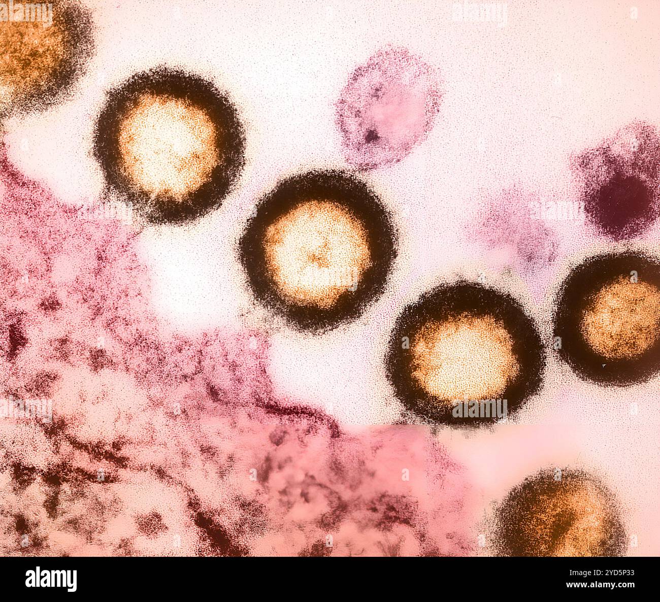 Transmission electron micrograph of HIV-1 virus particles (gold ...