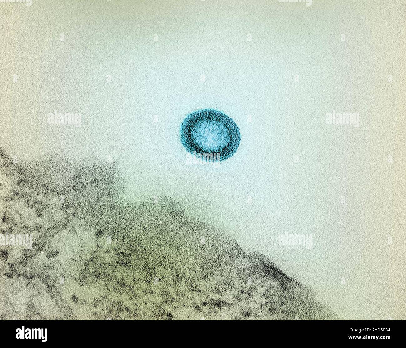 Colorized transmission electron micrograph of an extracellular HIV-1 ...