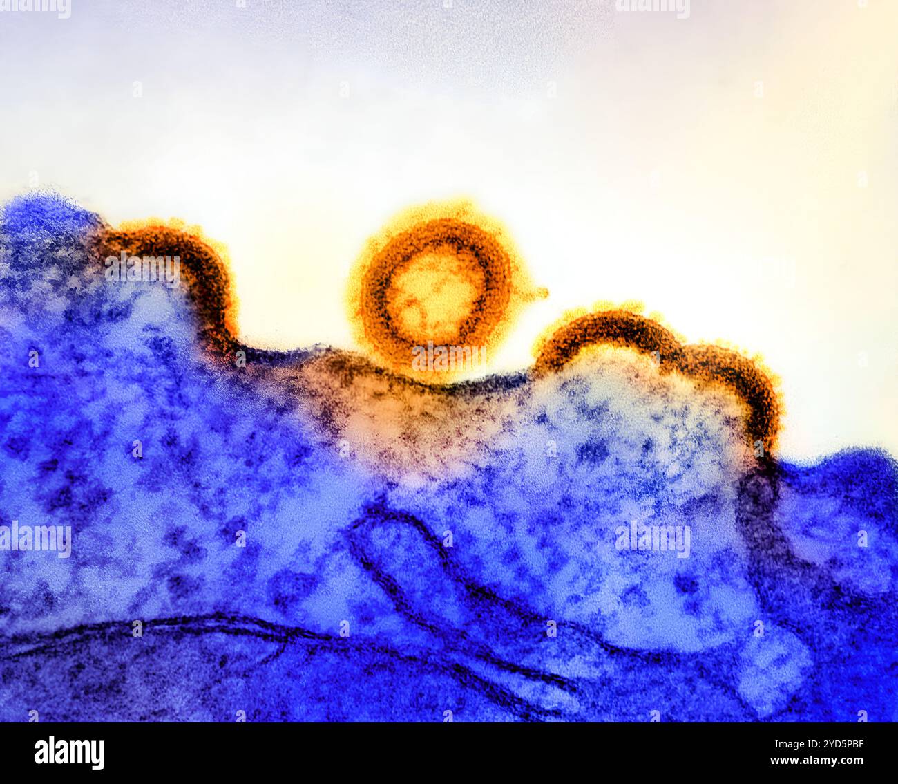 Transmission electron micrograph of HIV-1 virus particles (colorized ...