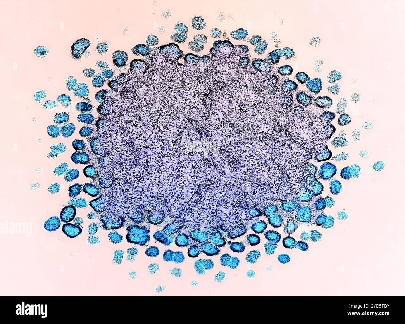 Colorized transmission electron micrograph of numerous HIV-1 virus ...