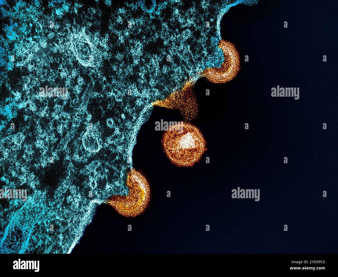 Transmission electron micrograph of HIV-1 virus particles (orange) from ...