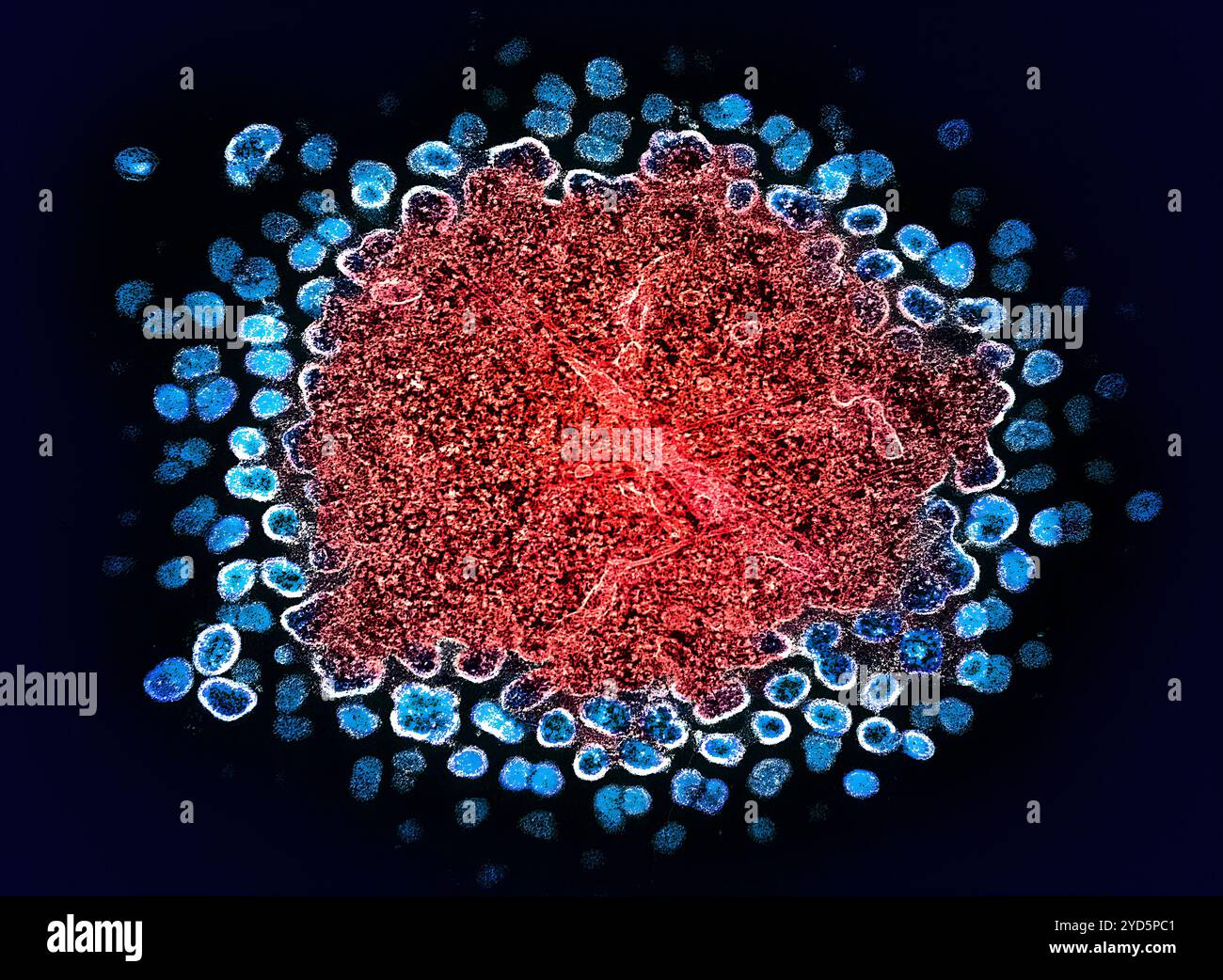 Colorized transmission electron micrograph of numerous HIV-1 virus particles (blue) replicating ...