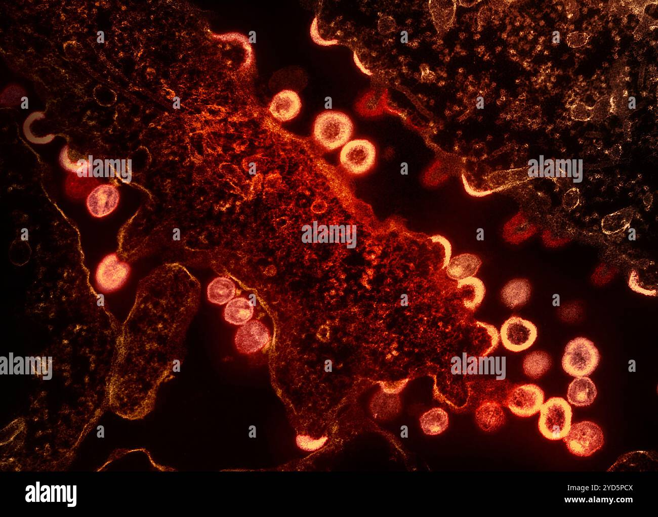 Transmission electron micrograph of HIV-1 virus particles (red/gold ...