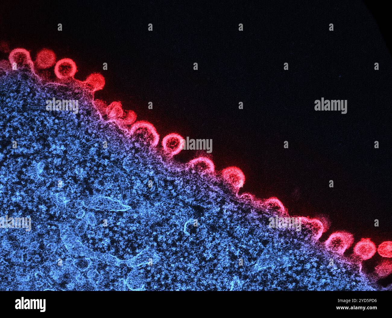 Colorized transmission electron micrograph of HIV-1 virus particles ...