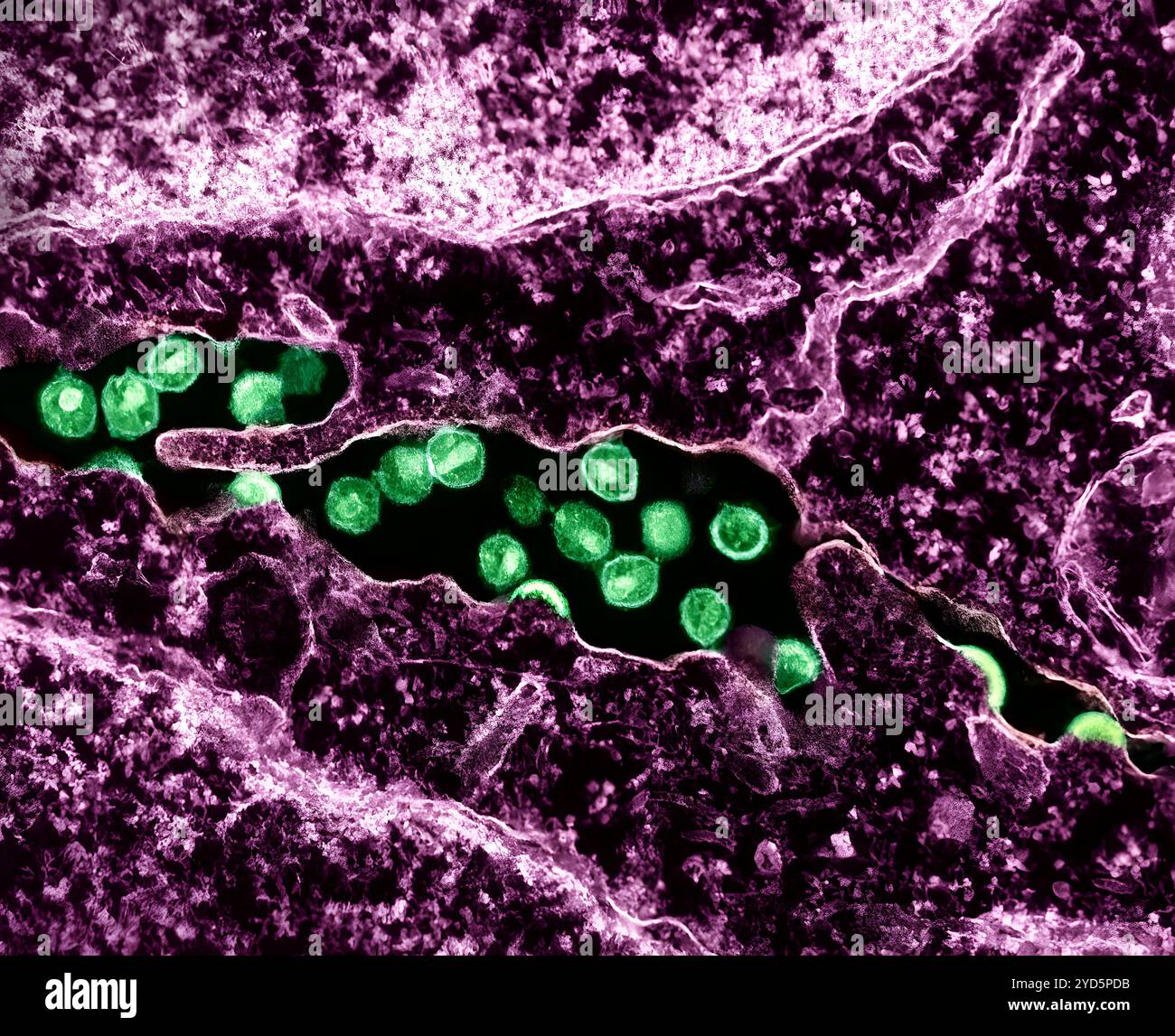 Colorized transmission electron micrograph of HIV-1 virus particles ...