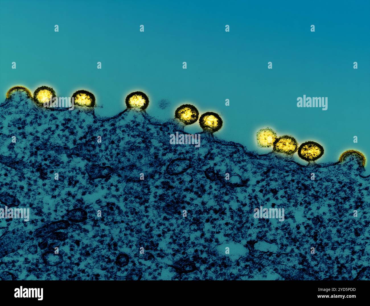 Colorized transmission electron micrograph of HIV-1 virus particles ...
