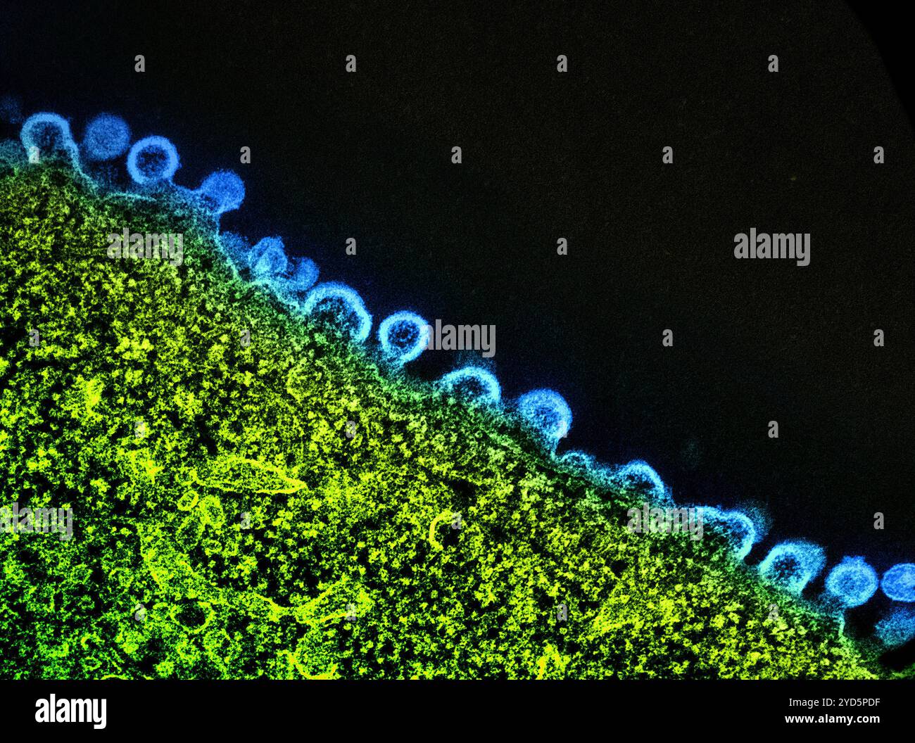 Colorized transmission electron micrograph of HIV-1 virus particles ...