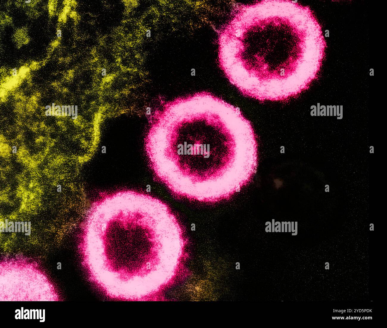 Transmission electron micrograph of HIV-1 virus particles (pink ...