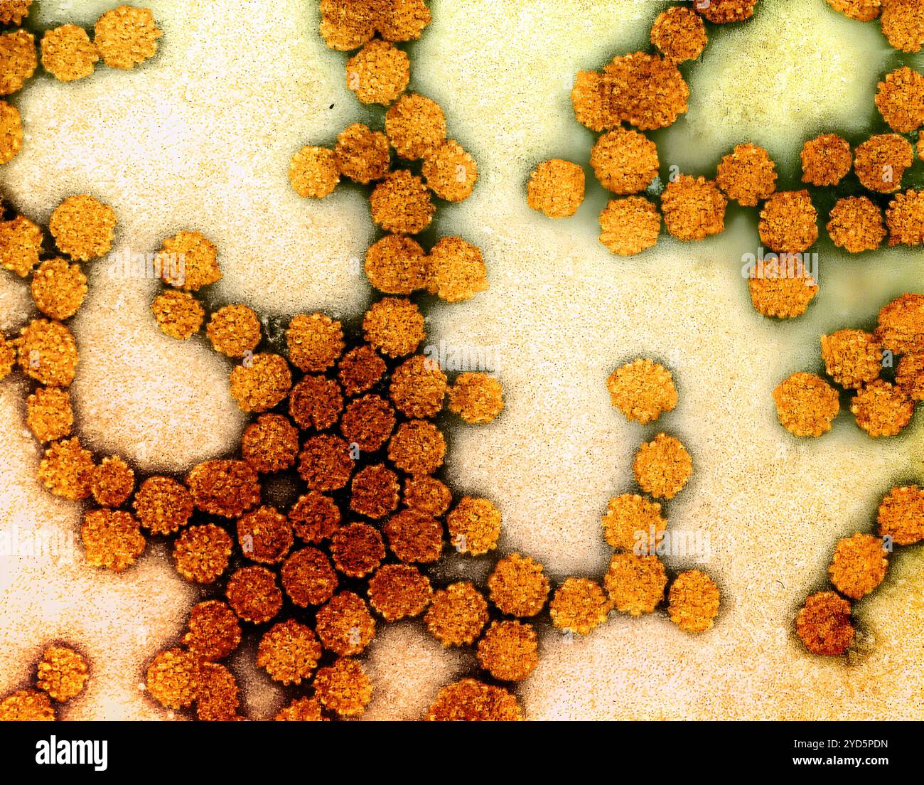 Colorized electron micrograph of HPV virus particles (gold and red ...