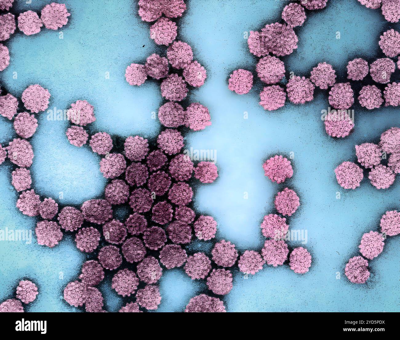Colorized electron micrograph of HPV virus particles (pink) harvested ...