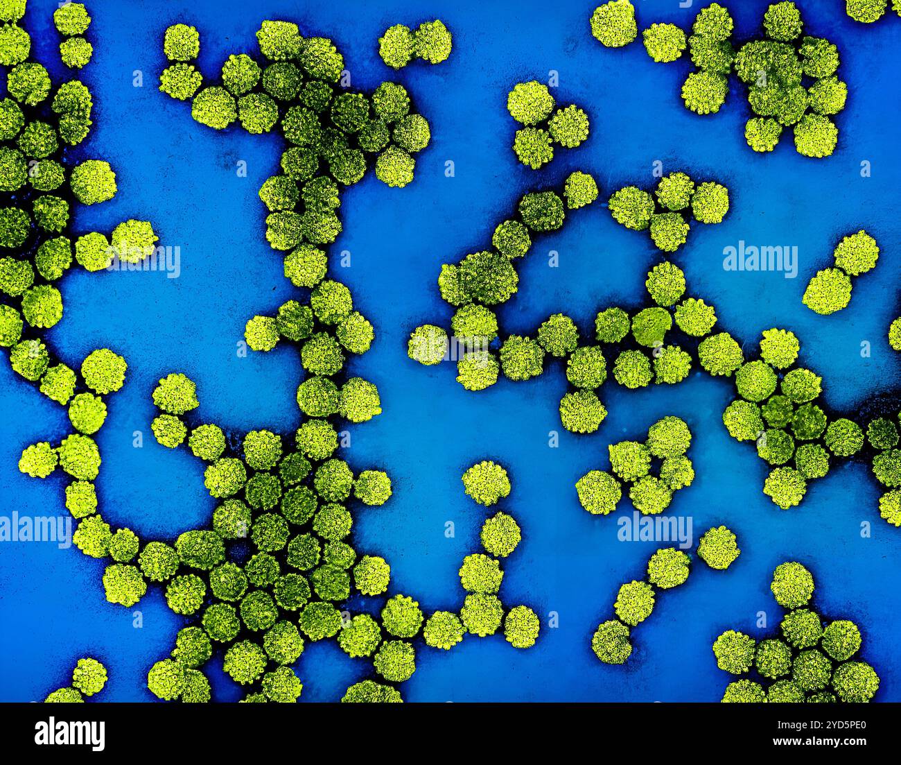 Colorized electron micrograph of HPV virus particles (yellow) harvested ...