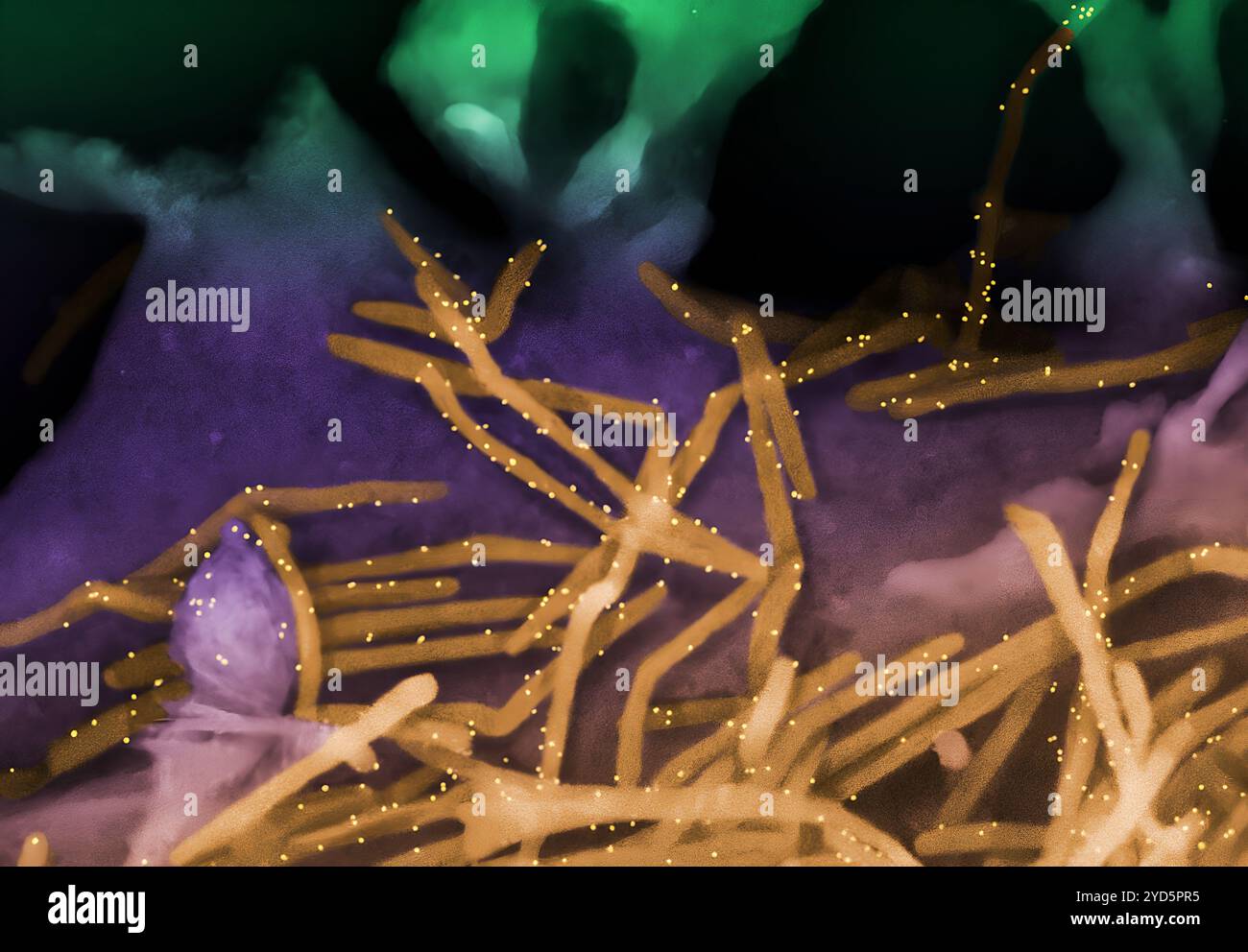 Scanning electron micrograph of human respiratory syncytial virus (RSV ...
