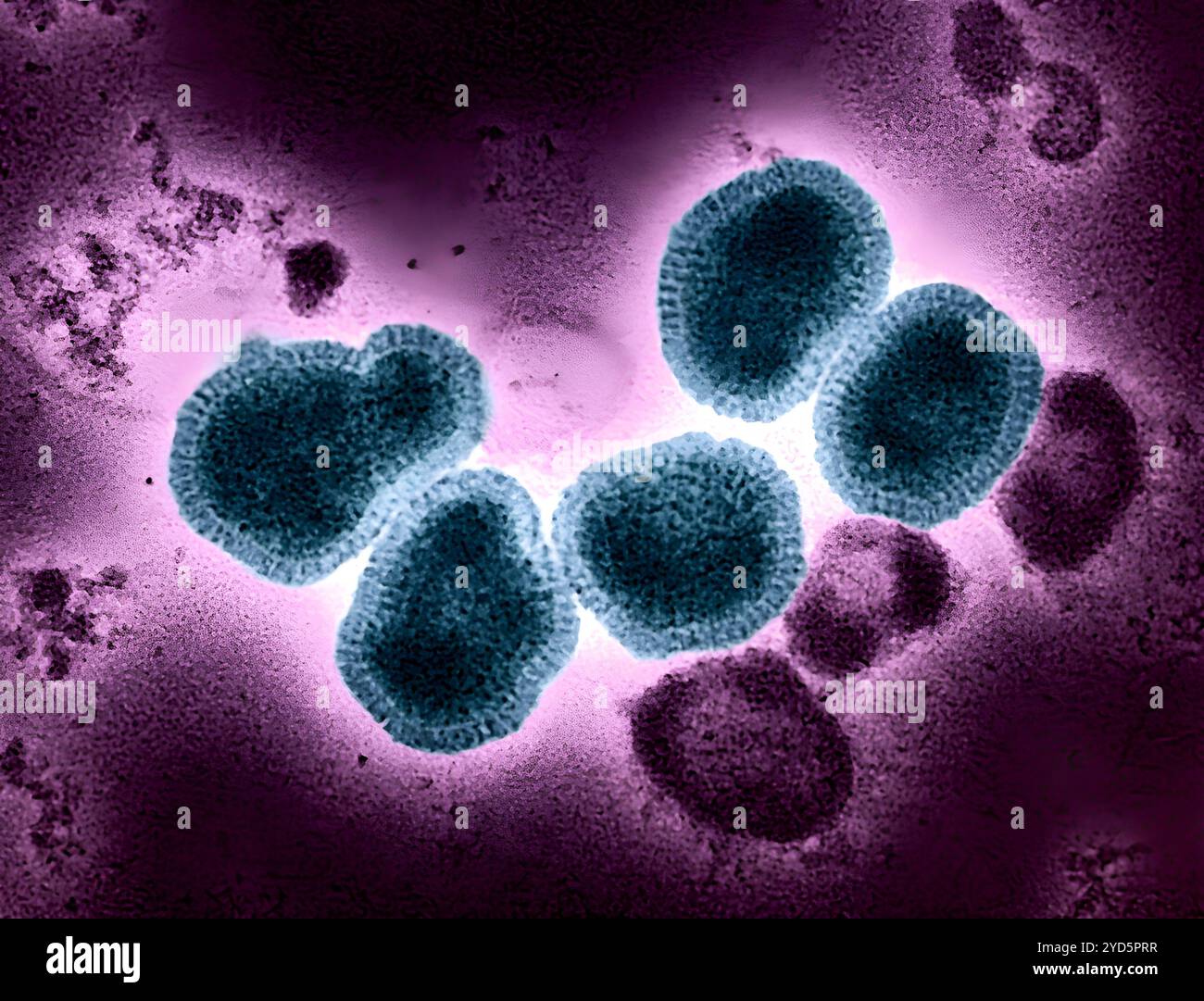 Colorized transmission electron micrograph of influenza A/H3N2 virus ...