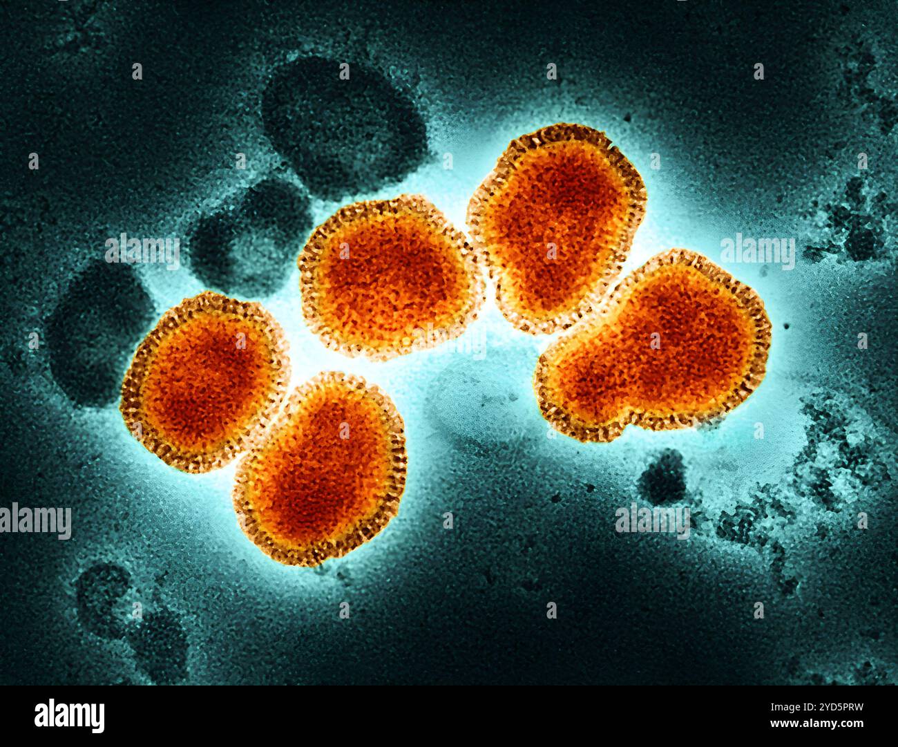Colorized transmission electron micrograph of influenza A virus ...