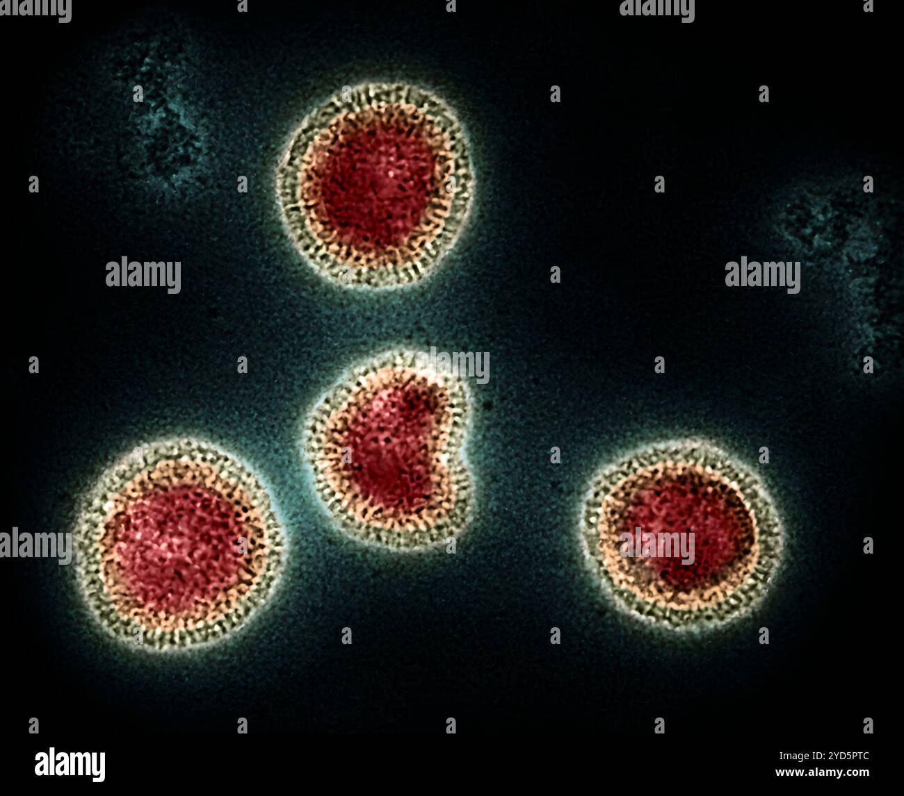 Influenza B virus particles, colorized red, gold, and green, isolated ...