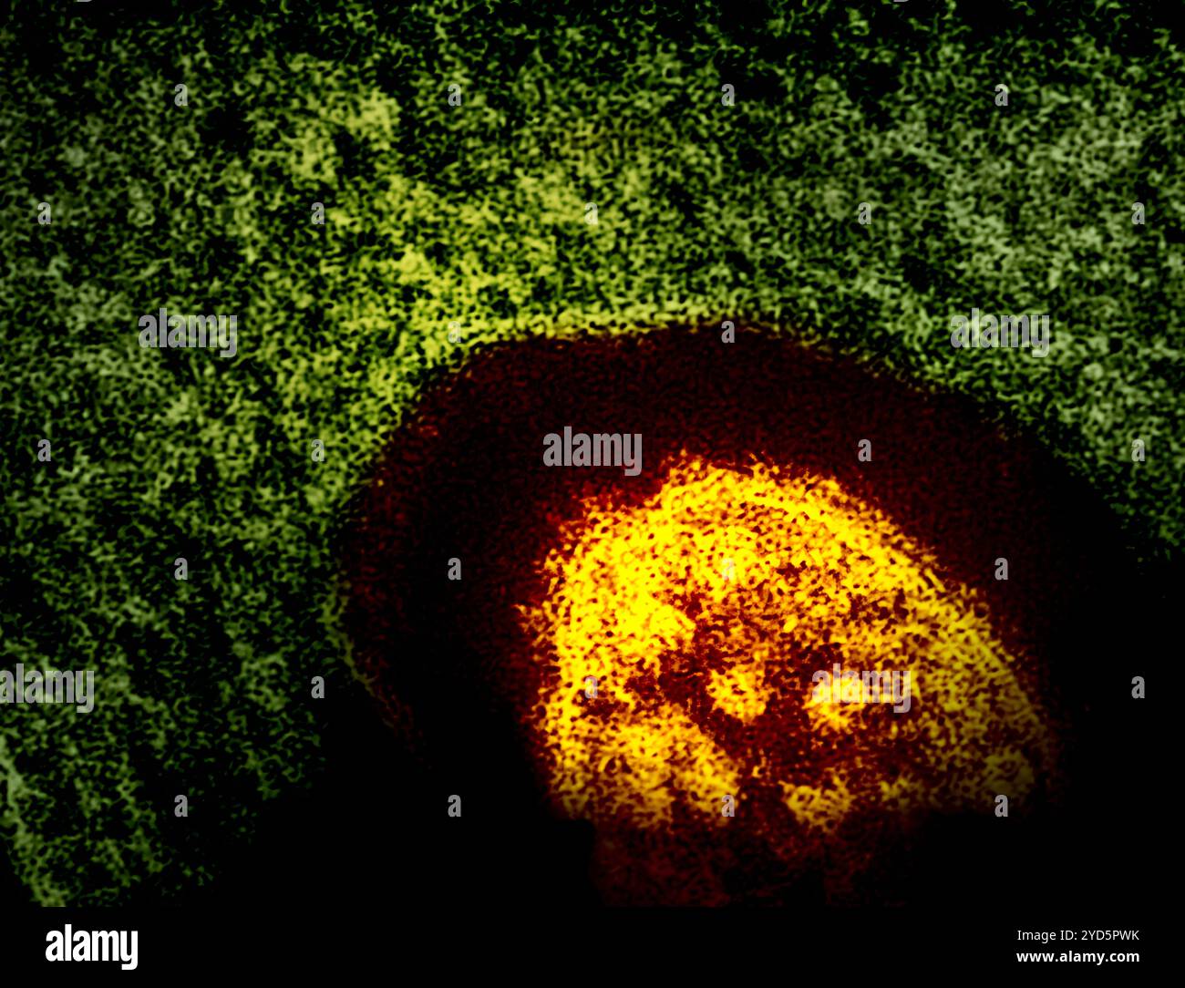 This transmission electron micrograph (TEM) revealed the ...