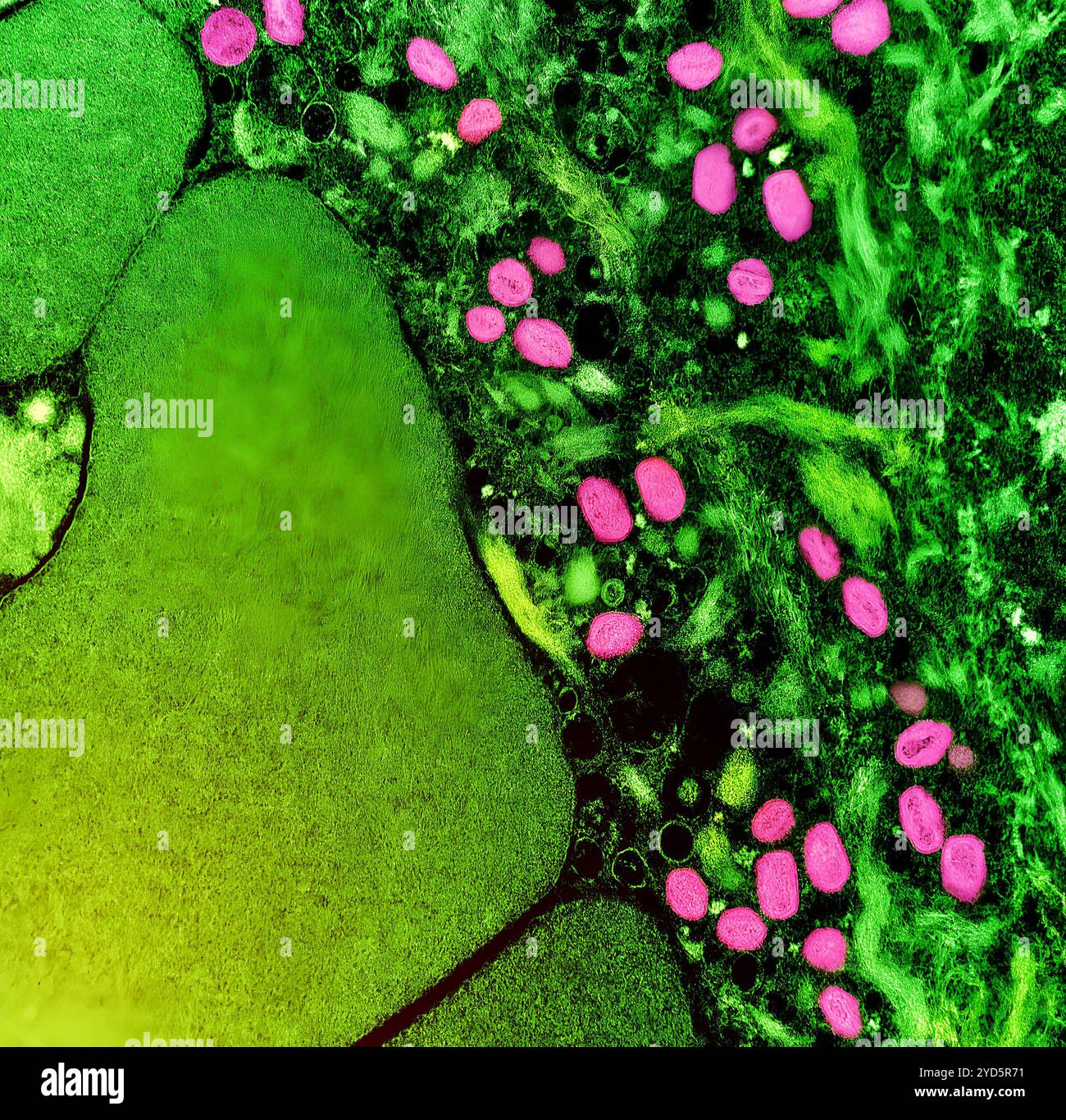 Colorized transmission electron micrograph of mpox virus particles ...