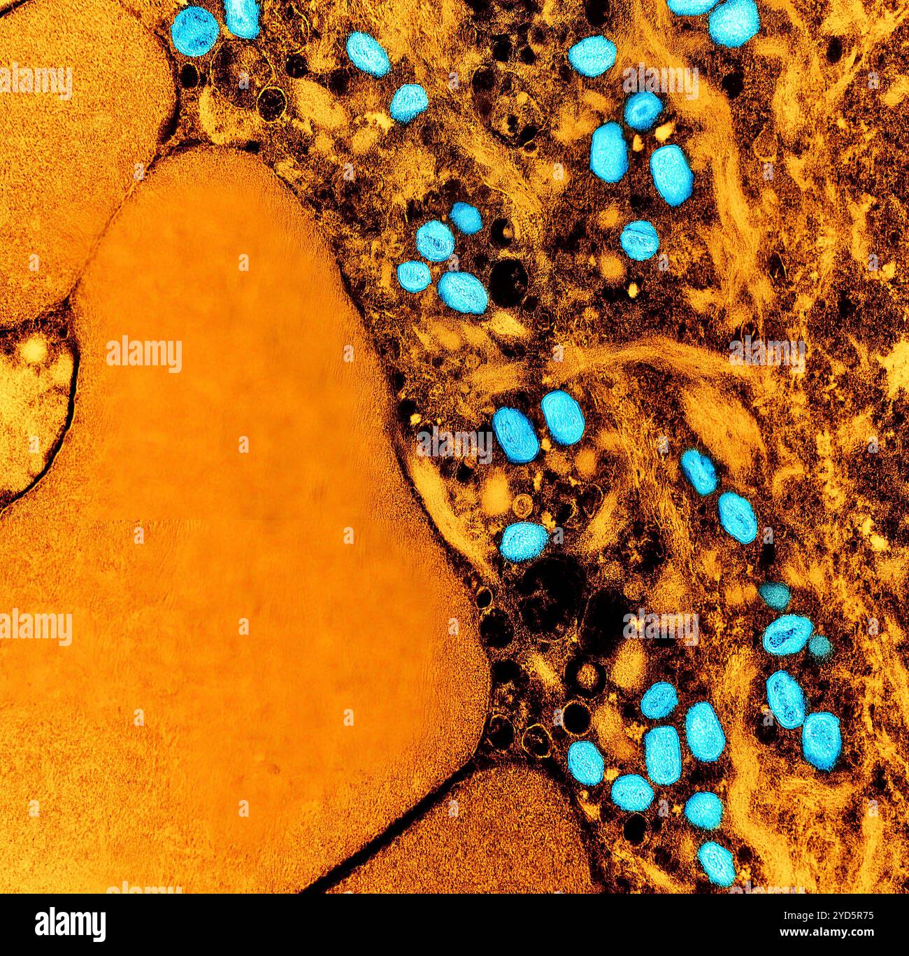 Colorized transmission electron micrograph of mpox virus particles ...